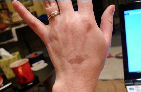 14 Amazing Birthmarks That Will Make Your Jaw Drop | Woman's World