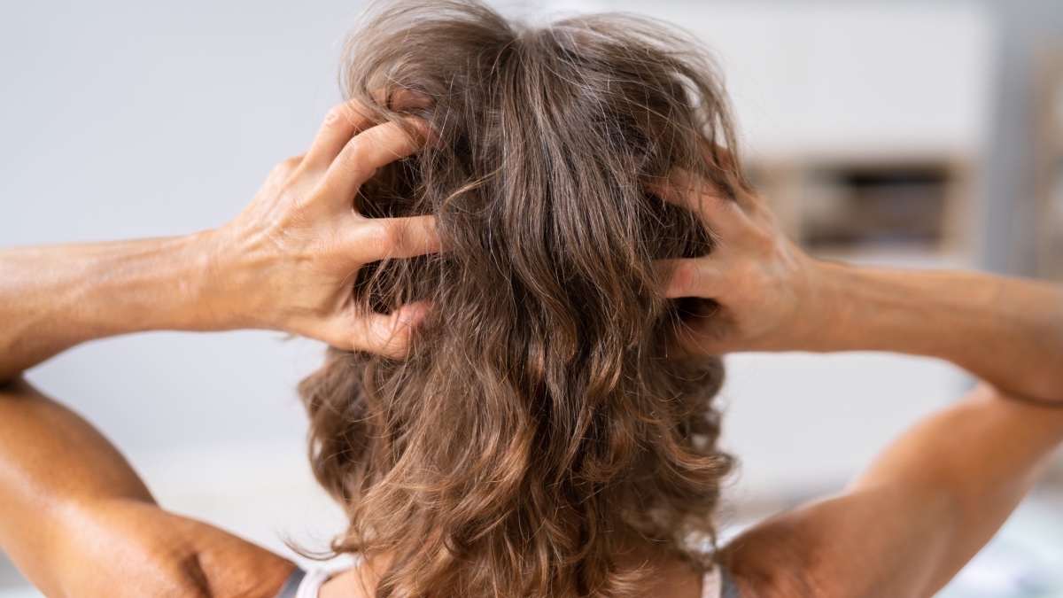 How to Spot Skin Cancer on the Scalp + 4 Ways To Cut Your Risk | Woman ...