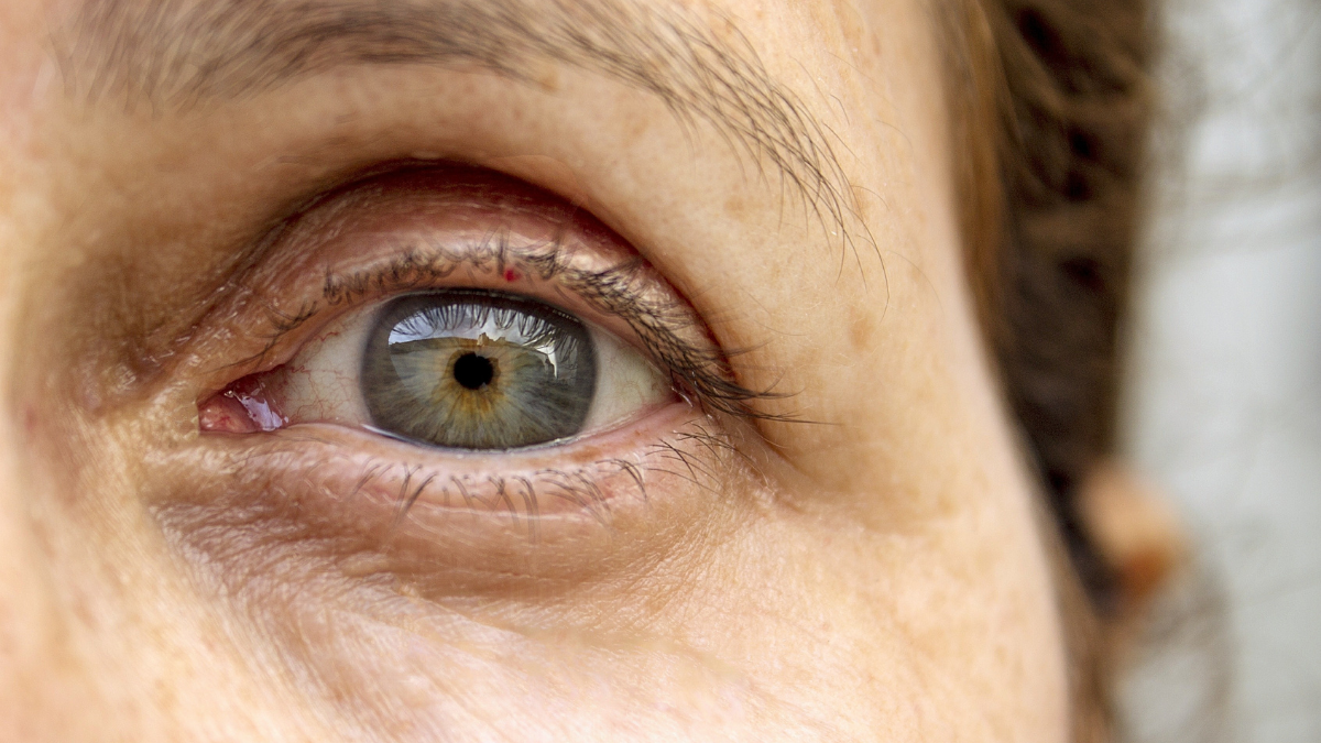 These Common Diabetes Meds May Prevent Glaucoma | Woman's World