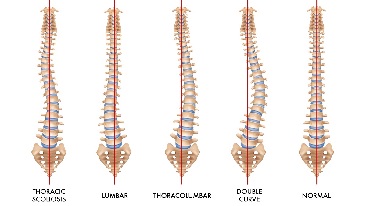 Uneven Hips Exercises: The Moves That Outsmart Back Pain | Woman's World