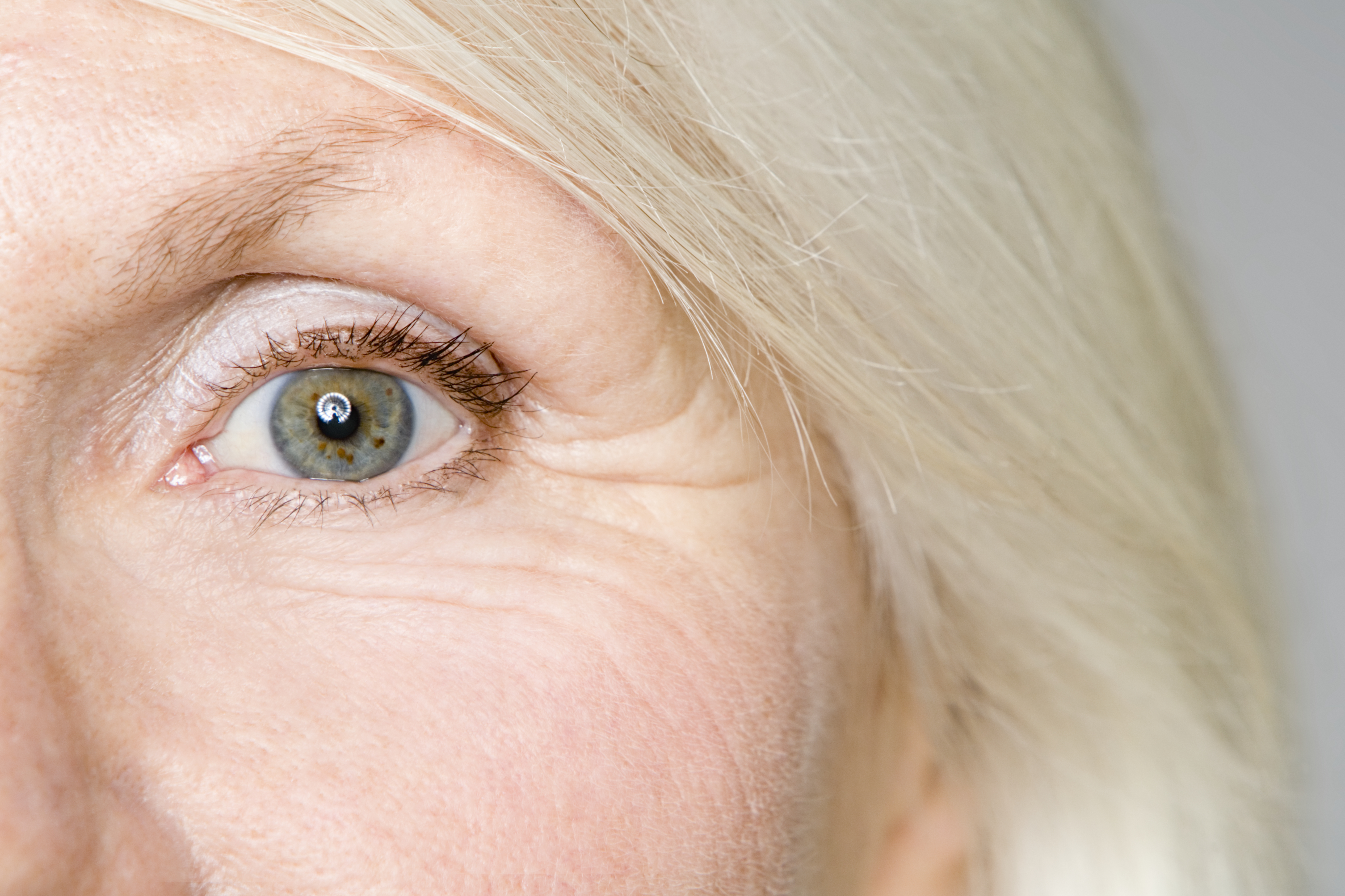 Dermatologists Share the Best Crow's Feet Remedies for Women Over 50 ...