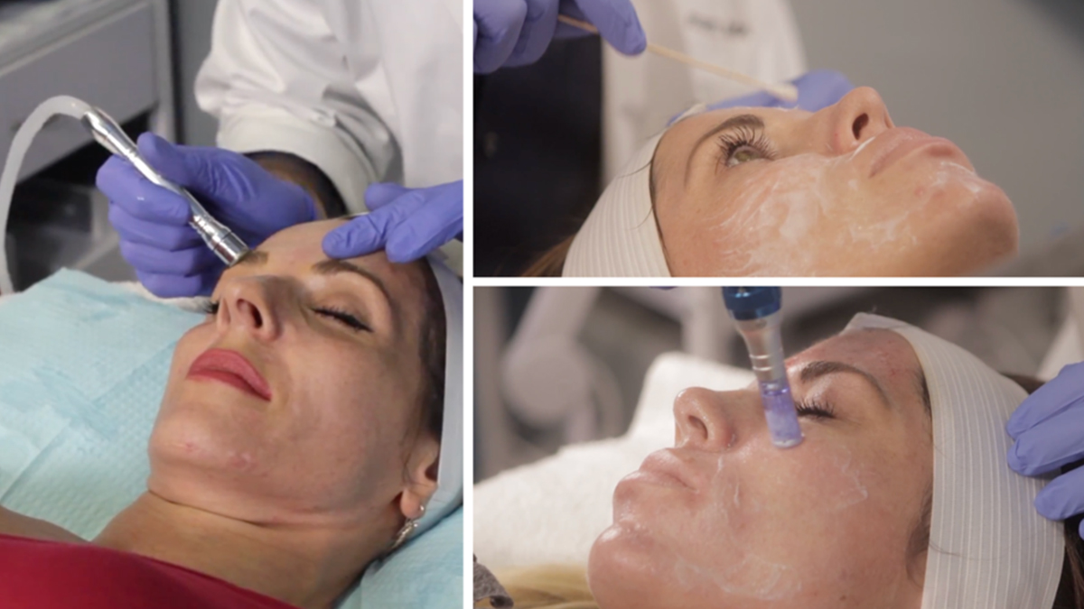 Liquivida Offers Skin Resurfacing Treatments to Restore Youthful Glow