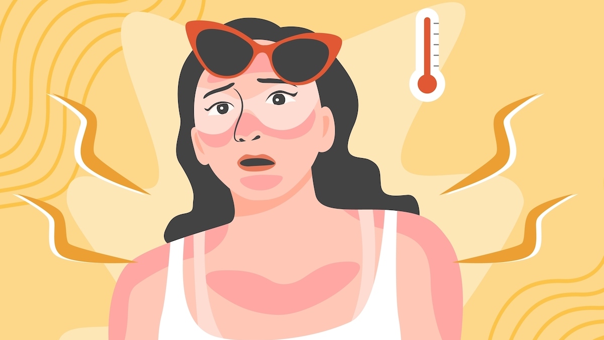How To Relieve and Get Rid of a Sunburn Fast | Woman's World