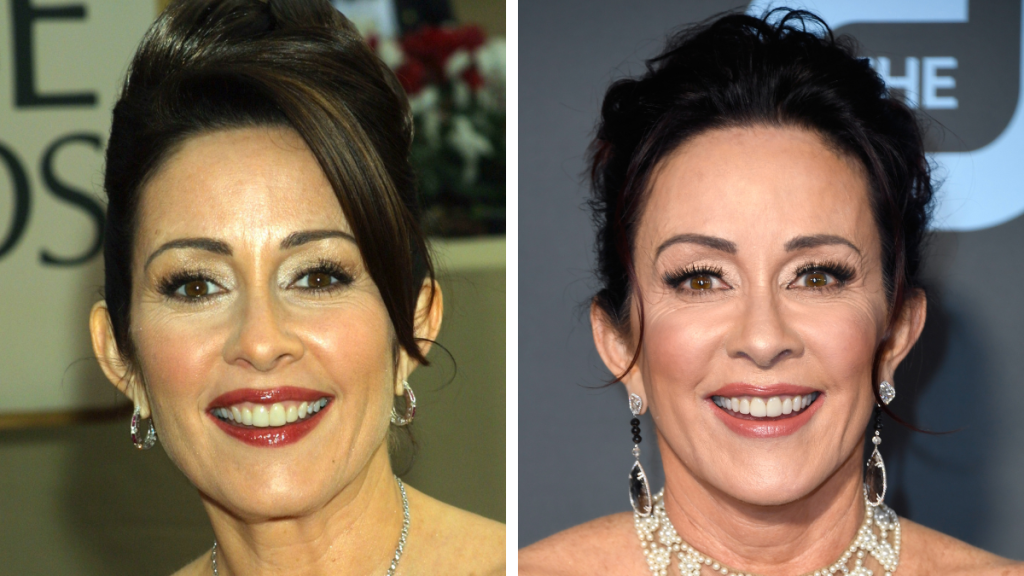 'Everybody Loves Raymond' Cast Then and Now | Woman's World