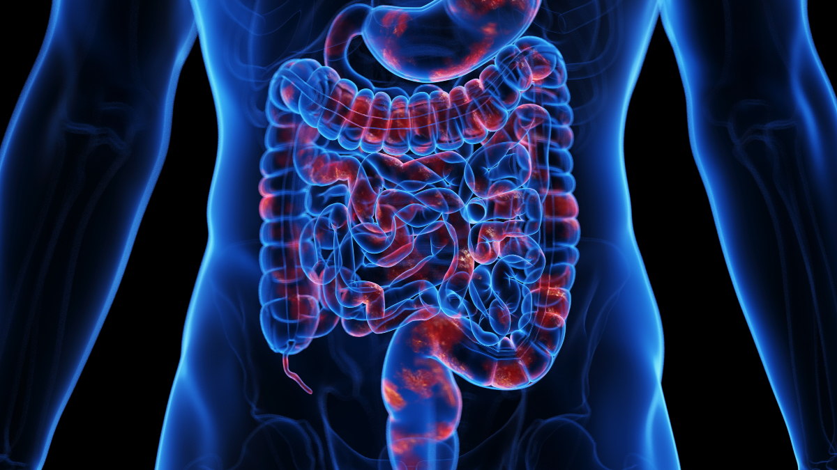 IBD vs IBS: Doctors Reveal the Difference + Best Remedies | Woman's World