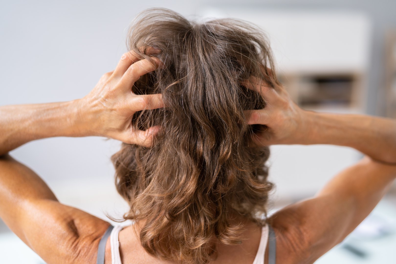 How Much Hair Loss Is Normal? MD Tips To Stop Excessive Hair Shedding ...