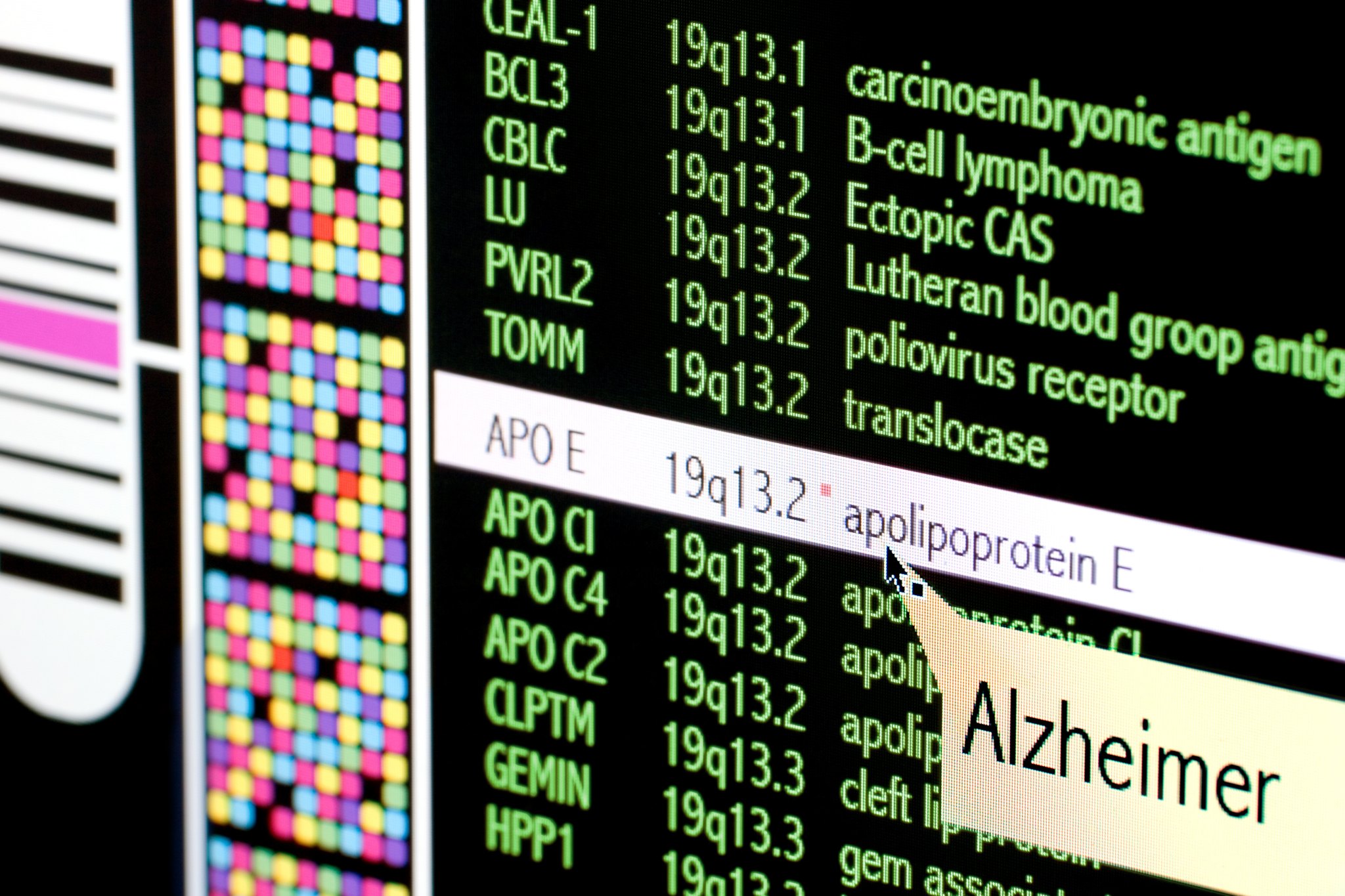 Is Dementia Hereditary? How To Reduce Your Risk of Memory Loss | Woman ...