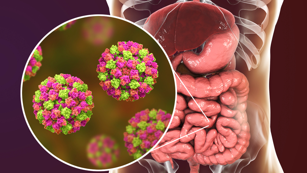 How Long Are You Contagious With Norovirus? Docs Weigh In | Woman's World
