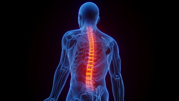 Pulled Muscle in Back: 4 Home Remedies To Ease the Ache | Woman's World