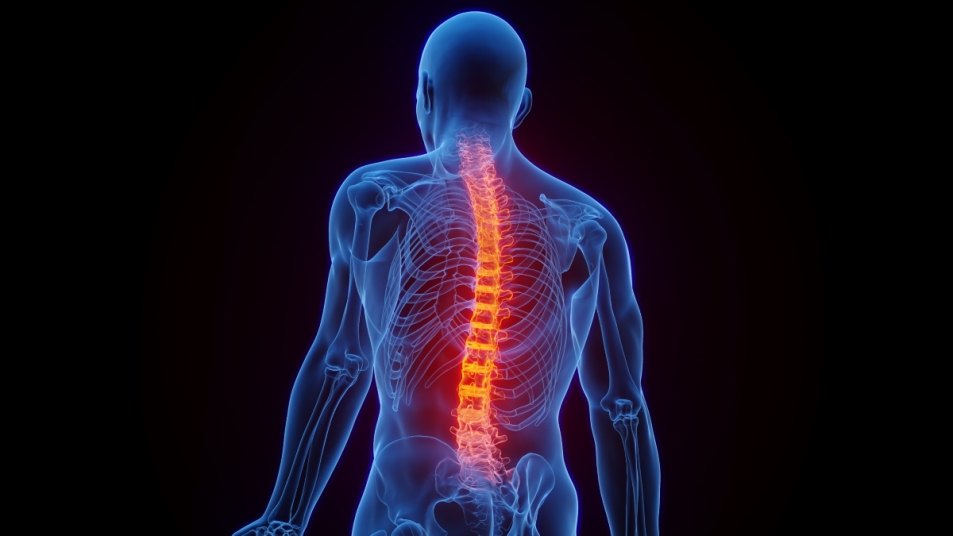 Pulled Muscle in Back: 4 Home Remedies To Ease the Ache | Woman's World