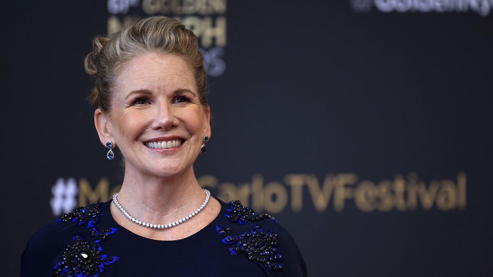 Why Melissa Gilbert, 61, Said Goodbye to Botox and Breast Implants ...