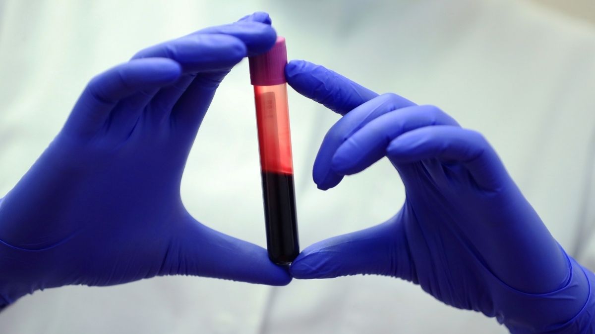Medicare Lab Test Changes 2026: What Seniors Should Know | Woman's World